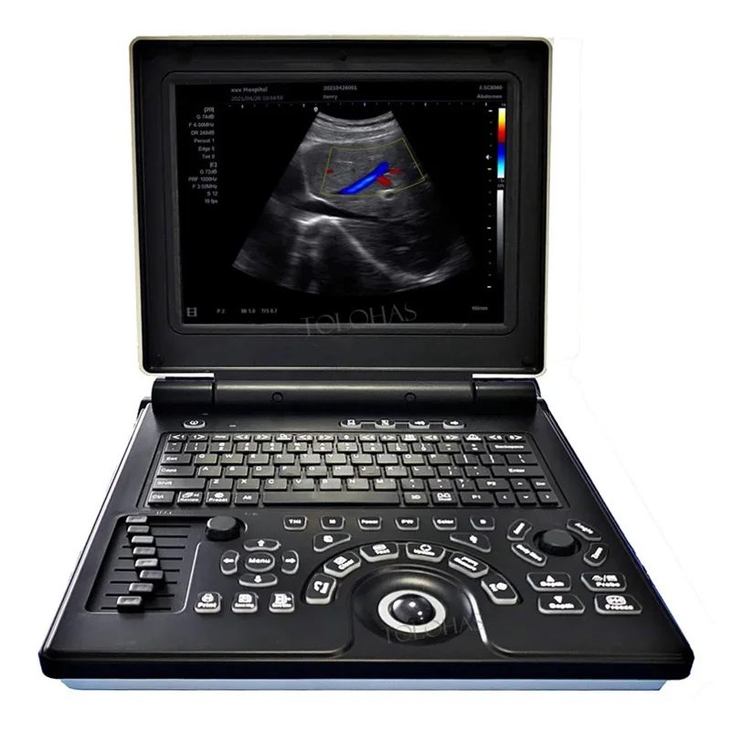 LHWE20 Dog Cat Ultrasound Vet Scanner Imaging Instruments Pet Color ...