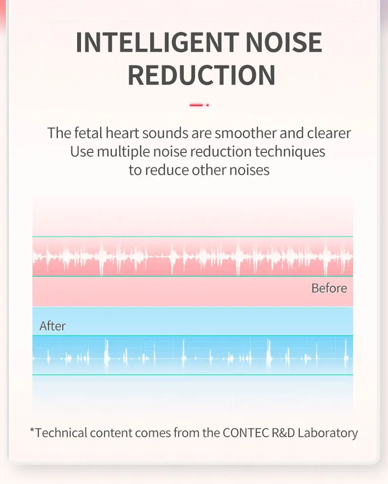 CONTEC10D Ultrasound Fetoscope - Digital Doppler Ultrasound