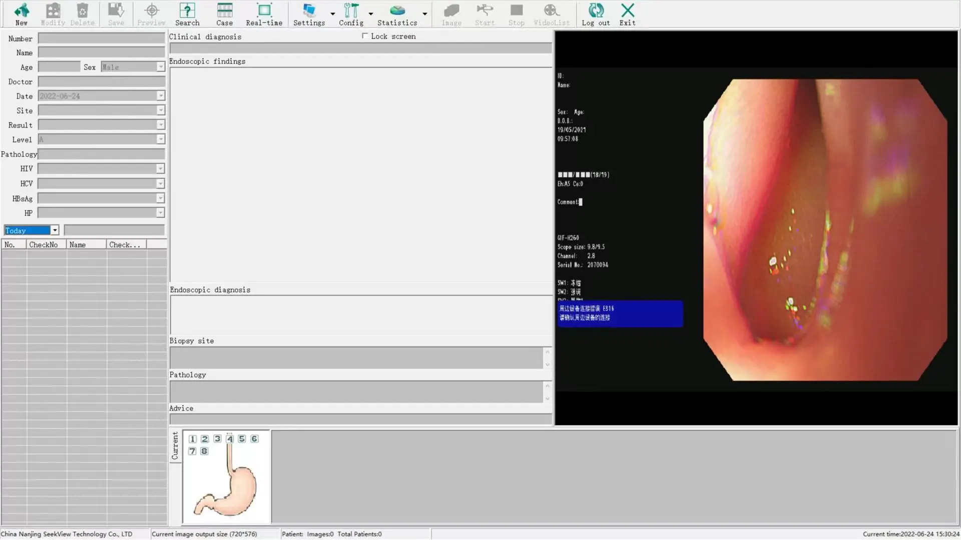 Gastroscope Endoscope Camera Endoscope System Gastrointestinal ...
