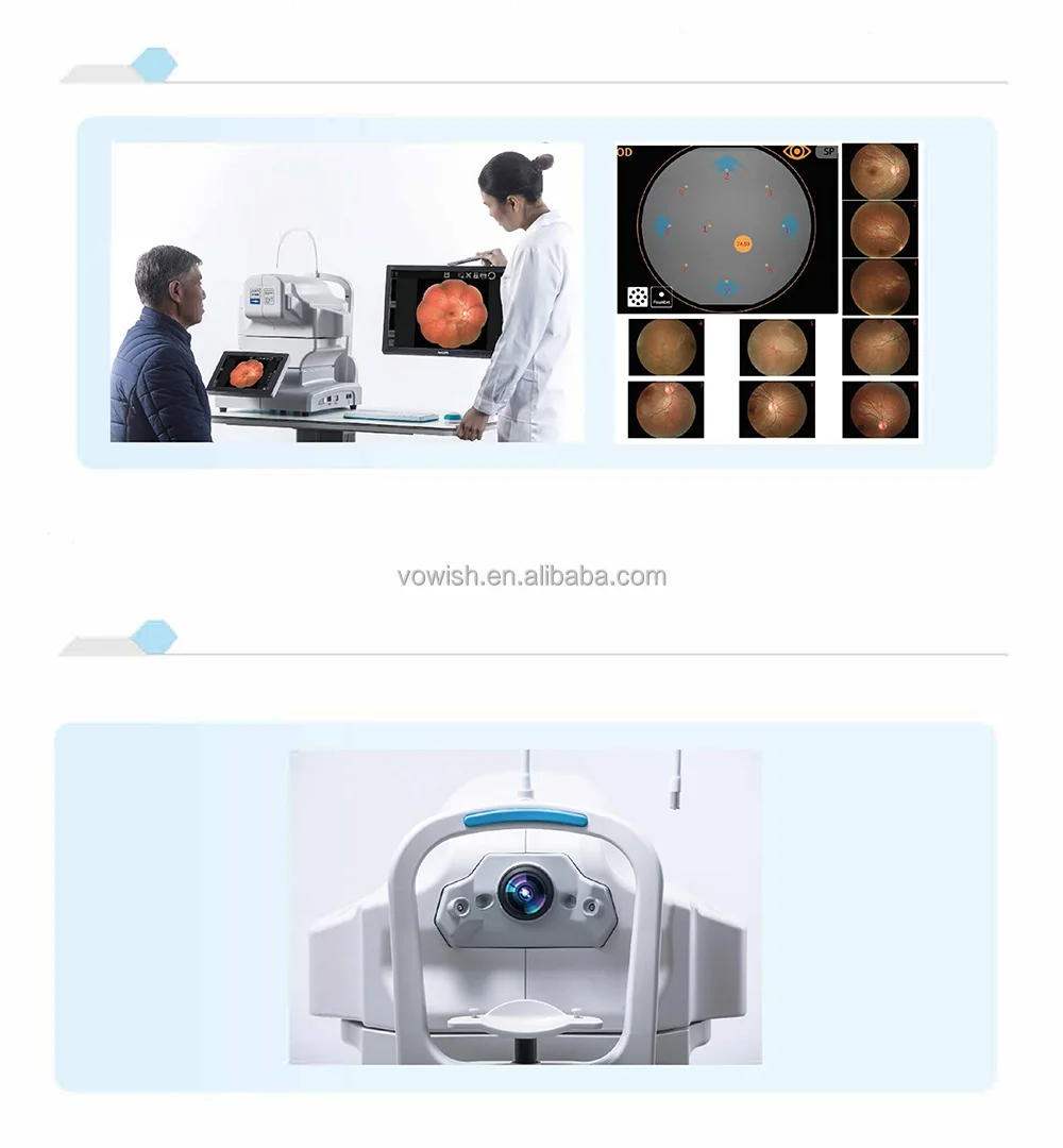 Reticam-3100 Ophthalmic Retinal Camera - Non-Mydriatic Fundus Camera by ...