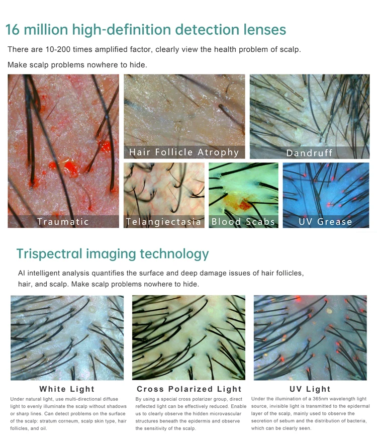 2025Portable New Medical electronic hair detector intelligent AI ...