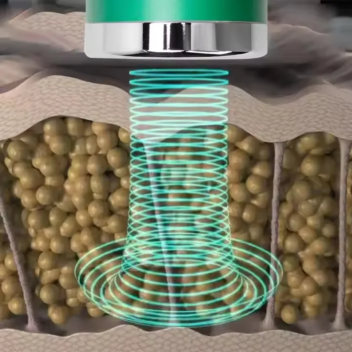 Alibaba.com: Cool Body Waves 3-in-1 RF skin tightening machine for body ...