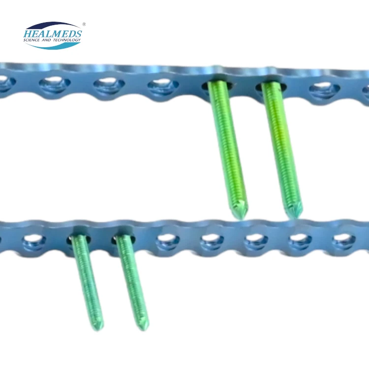 Orthopedic Implants Bone Screws Veterinaria Titanium Alps Locking ...