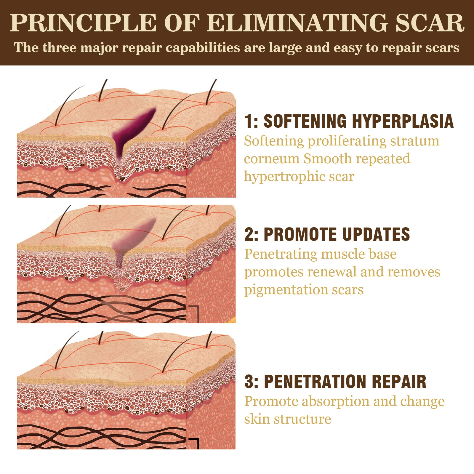Jaysuing Scar And Acne Marks Removal Repair Collagen Scar Treatment ...