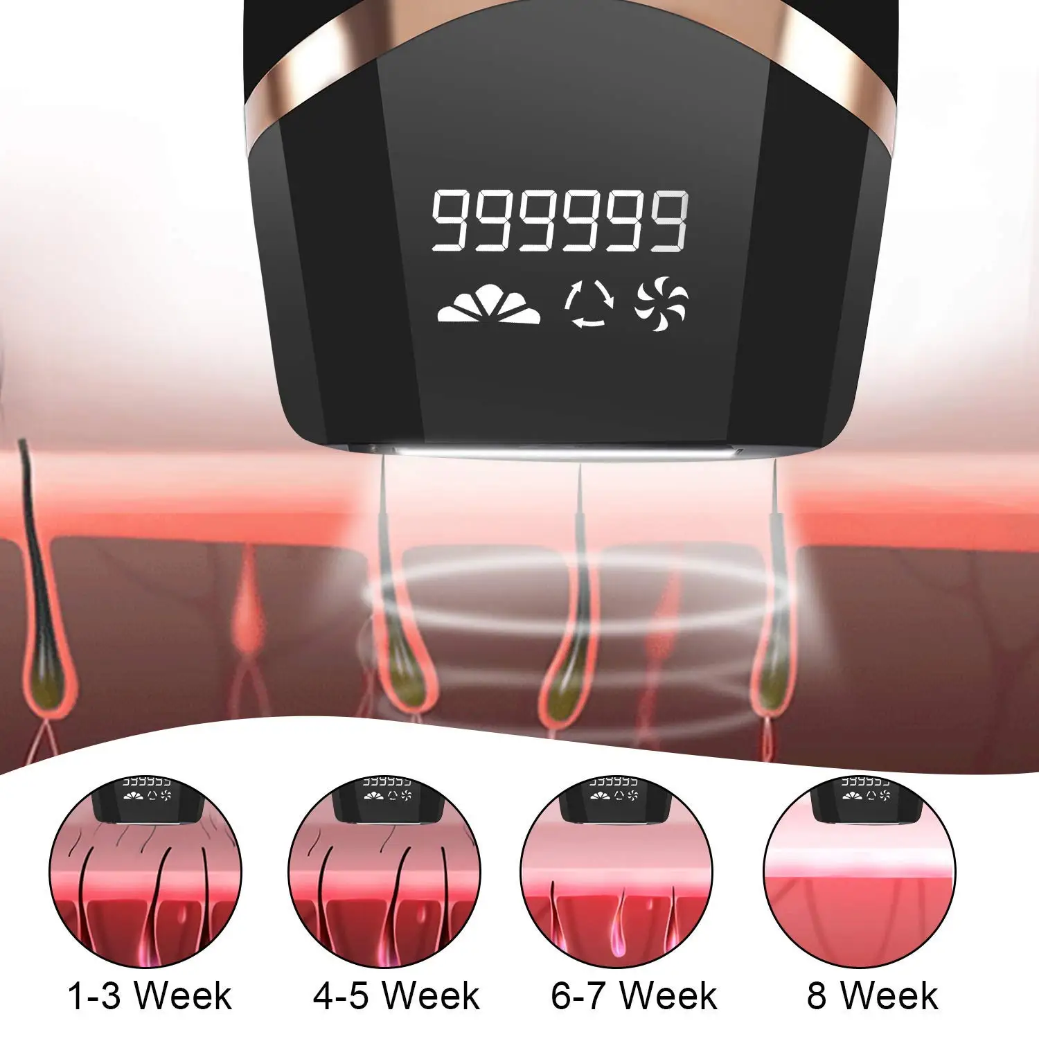 IPL Hair Removal Machine - Painless Laser for Home Use