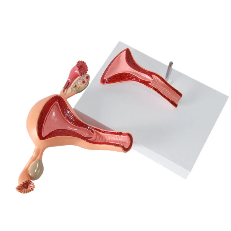 Human Uterus Model for Medical Teaching - MAXCARE MAC-TM185
