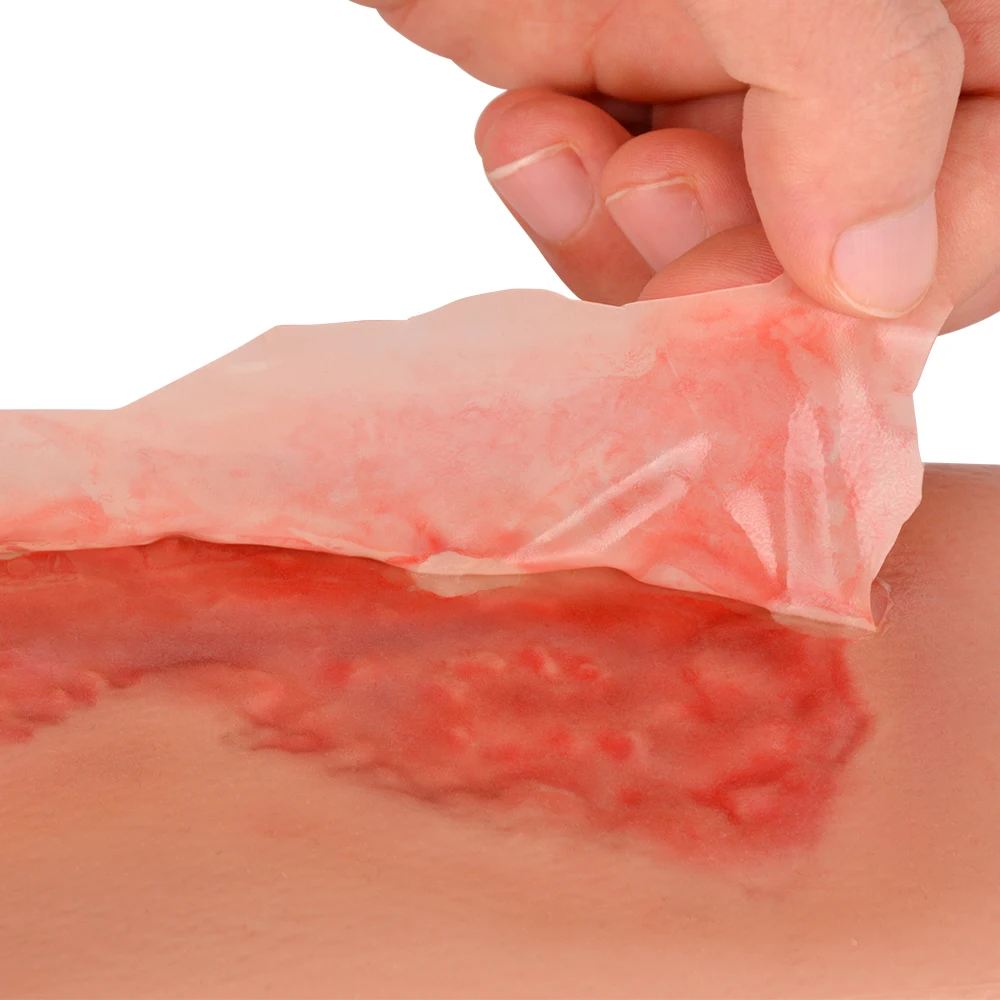 The Wearable Abrasion Wound Sleeve, Abrasion Wound Cuff Model, Silicon ...