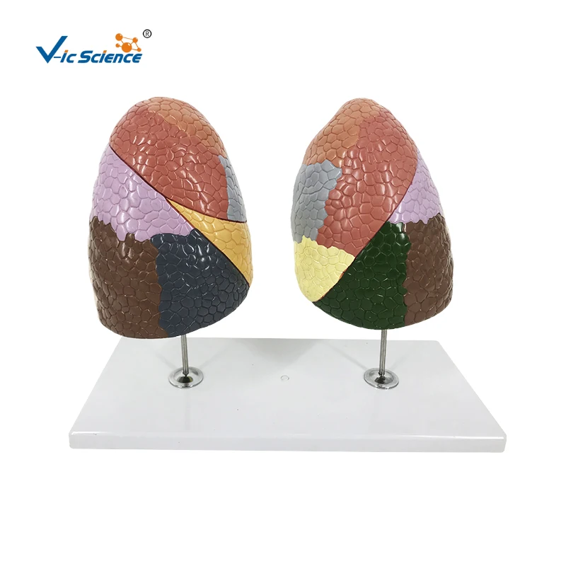 Segmental Lungs Lungs Anatomical Model Medical Teaching Aids Model ...