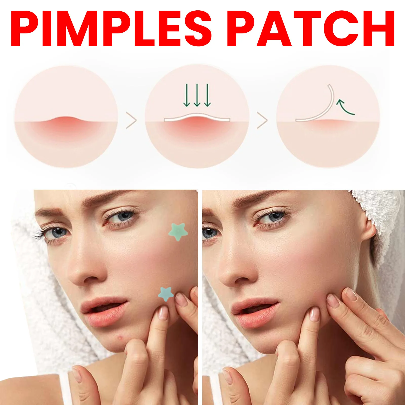 Jaysuing Pimple Patch - Repair Skin Acne Marks Effectively