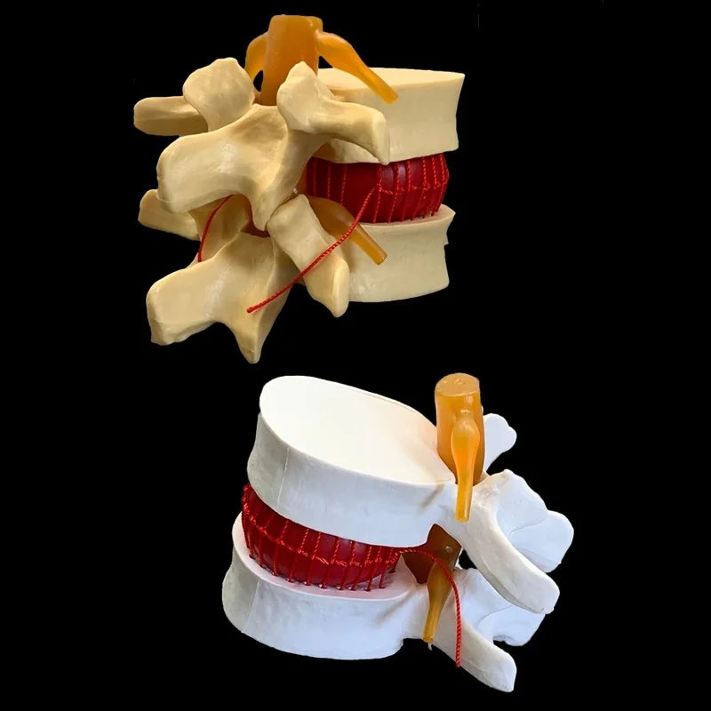 Spine Model Human Spine Model Full Size Demonstration Model of Human ...