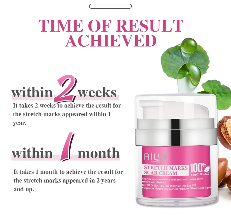 Ailke Stretch Mark Removal Cream Natural Vitamin E Safe & Effective ...