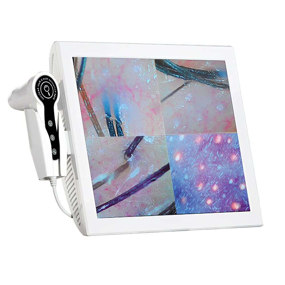 beauty hair test treatment skin diagnosis hair follicle analyzer ...