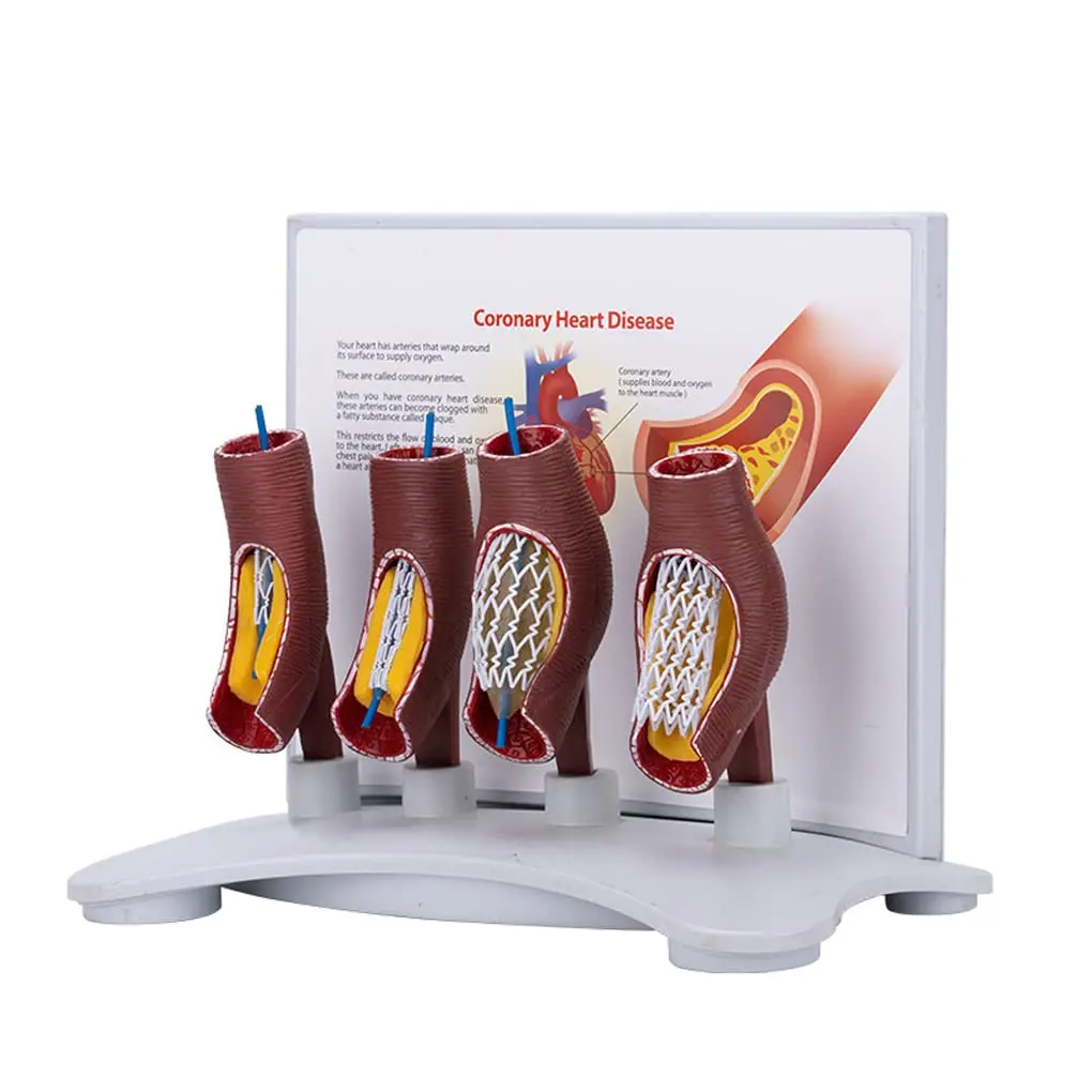KyrenMed Human Vascular Stent Model Coronary Artery Cardiovascular ...