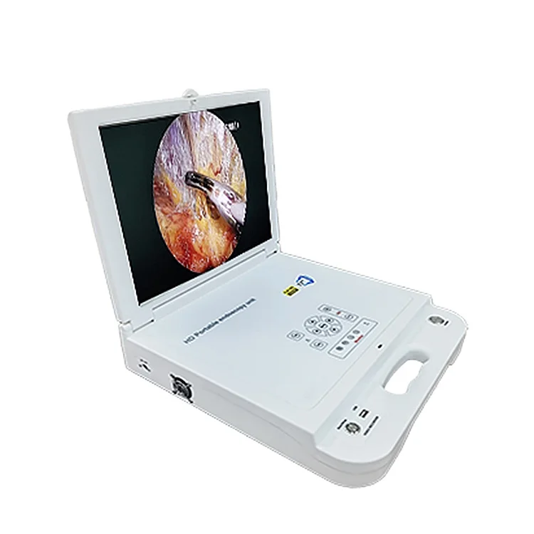 SHREK Medical HD Sinuscope Endoscope for Abdominal Surgery