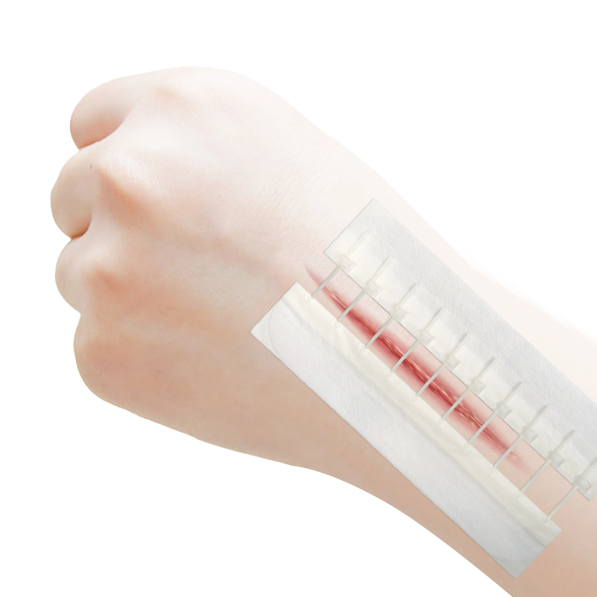 Butterfly Steri Strips | ubicaciondepersonas.cdmx.gob.mx