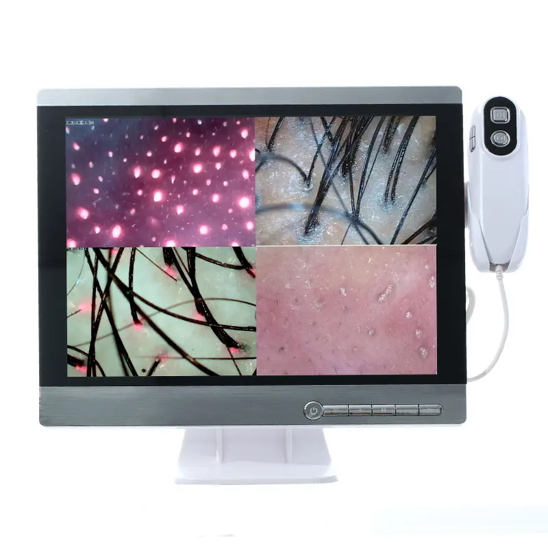 2024 Best Selling Smart Skin Analyzer Client Management Facial Skin ...