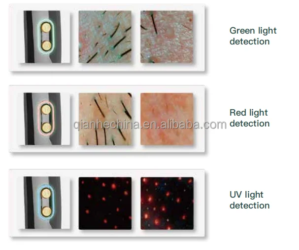 8mp Uv Skin Analysis Machine Facial Reveal Imager Skin Analysis Camera ...