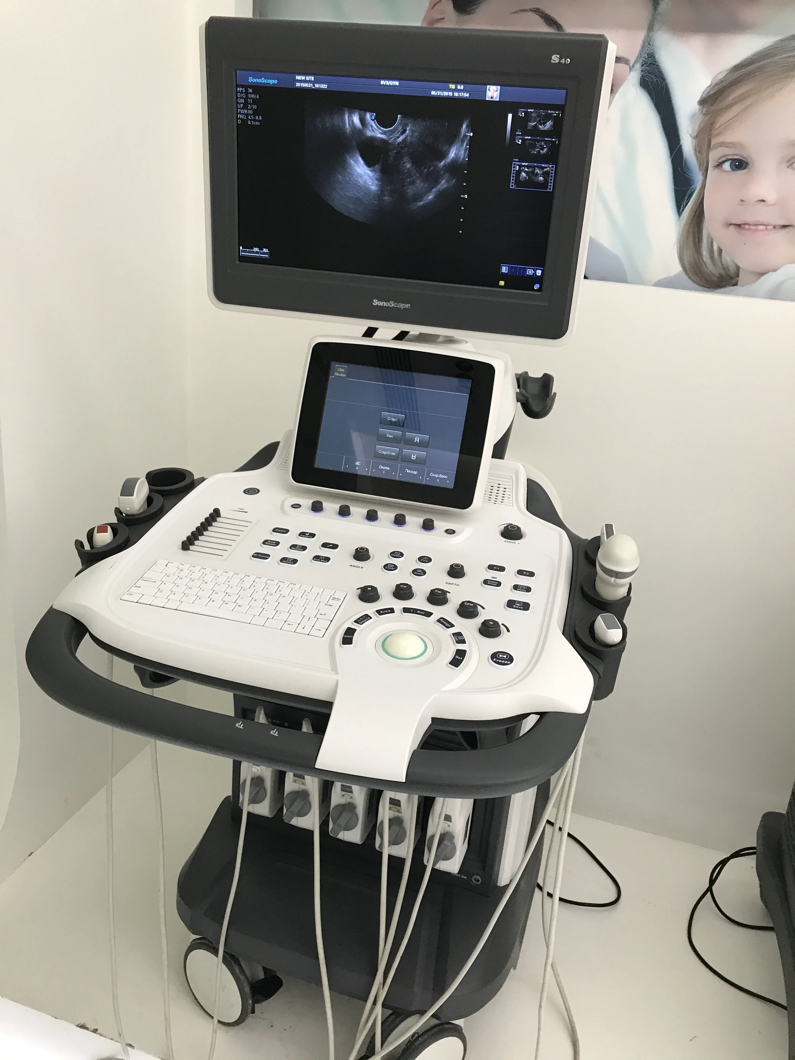 Sonoscape S40 4D Ultrasound Machine for Sale | Color Doppler Trolley ...