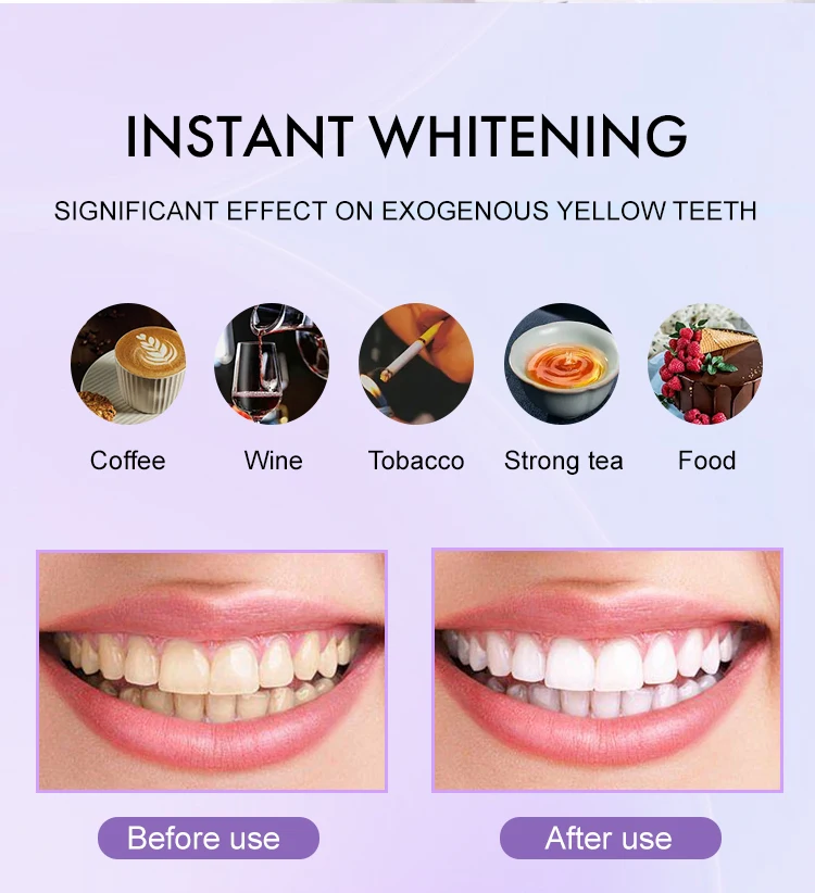 Tooth Whitening Toothpaste Non Foaming Toothpaste Purple Toothpaste For ...