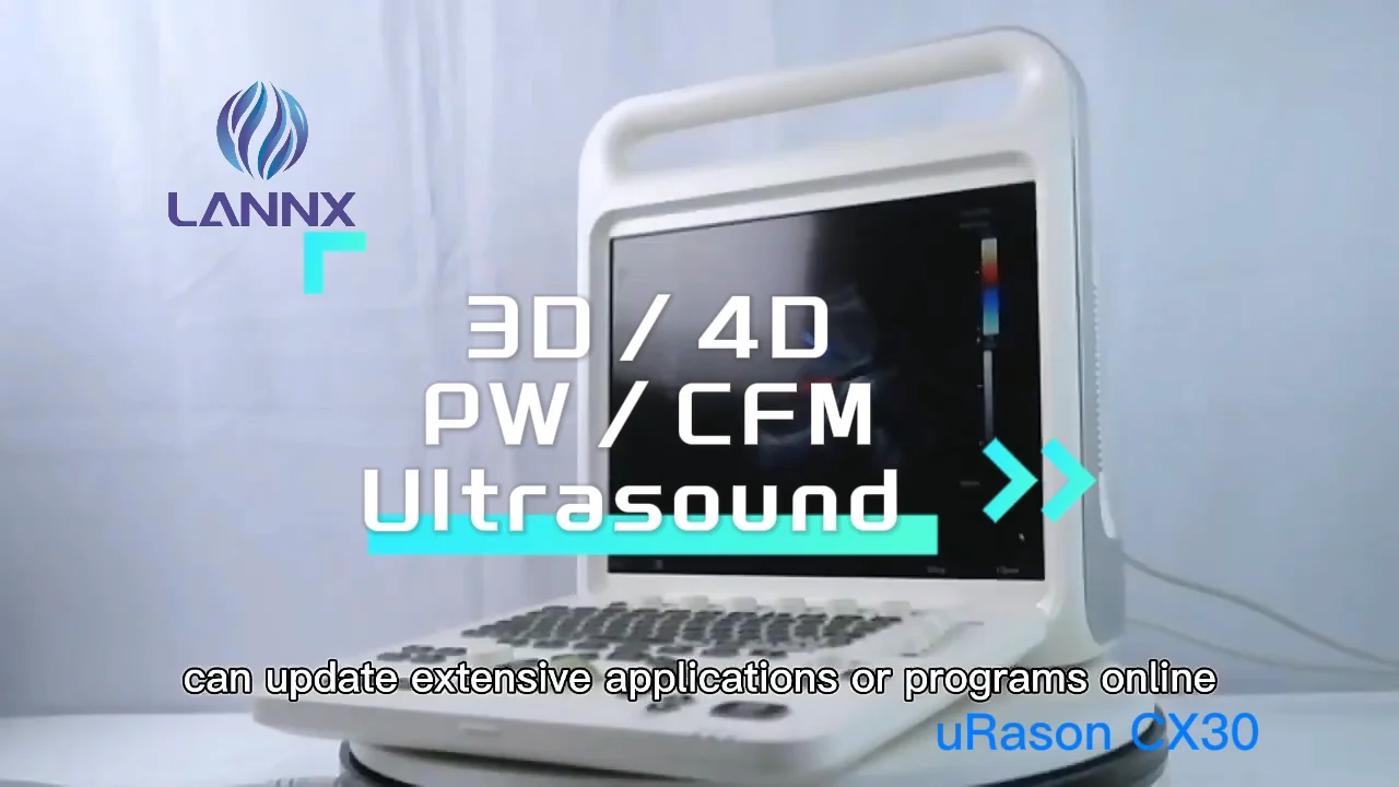 Lannx Urason Cx30 Professional Hospital 3d/4d Ultrasound Scanner Obstetrics Gynecology Color ...