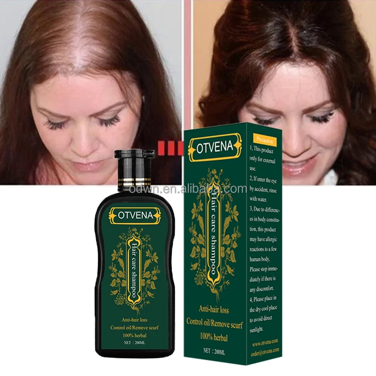 Otvena Anti Hair Loss Hair Regrowth Shampoo And Conditioner - Buy Hair ...