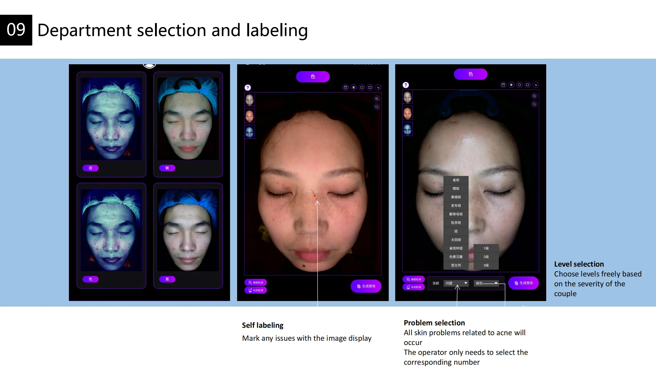 Bitmoji Max Ai Smart 3d Skin Detector 8 Spectrum Digital Analyzer Face ...