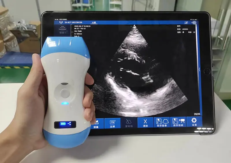 Veterinary Handheld Ultrasound: Advanced Wireless Precision Diagnostics ...