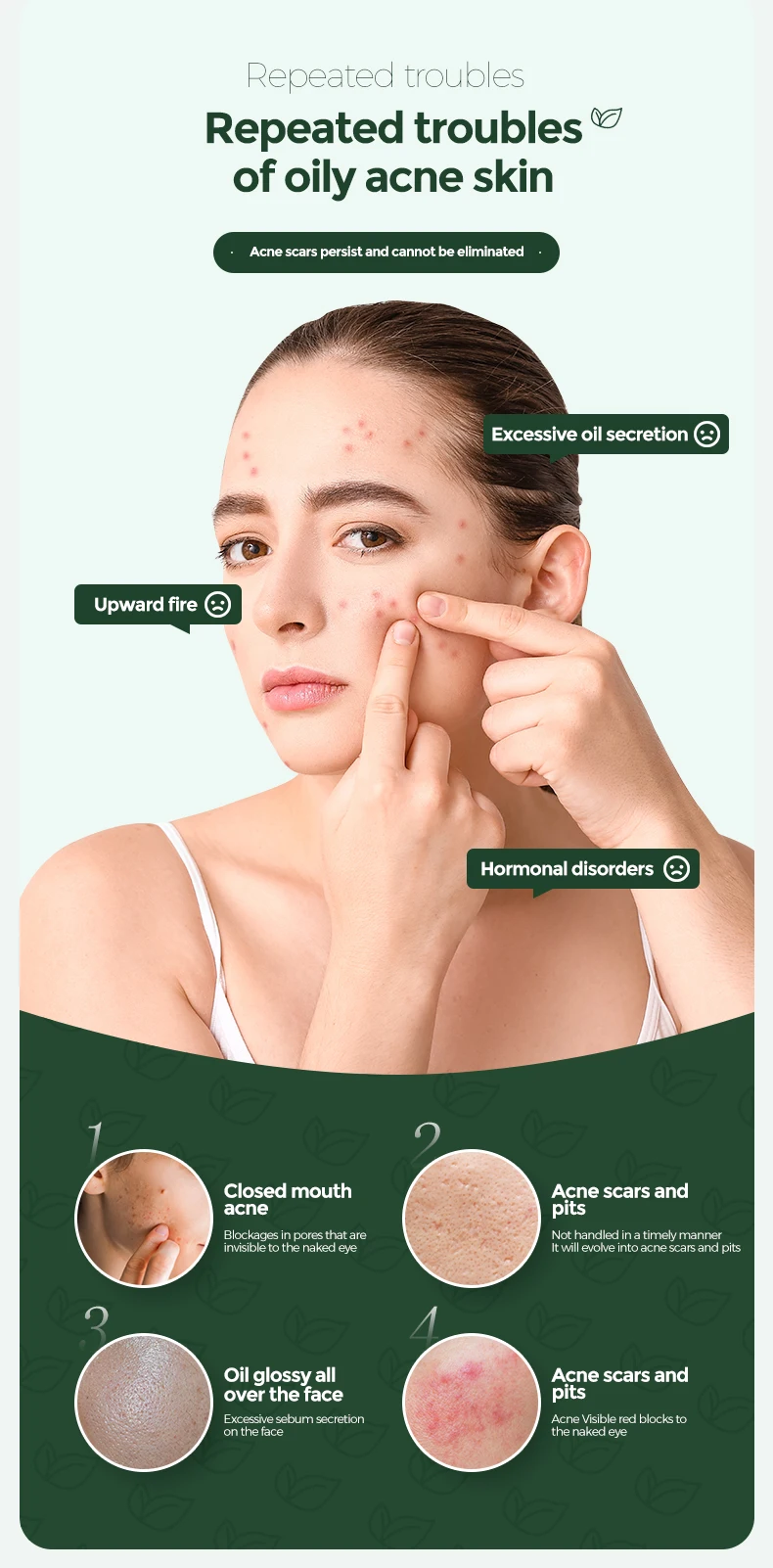 Panox Benzoyl Peroxide Pearl Beauty Private Label Professional Removal ...