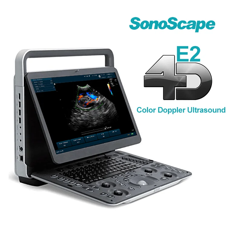 Sonoscape E2 3D 4D Ultrasound - Advanced OB/GYN Diagnostics