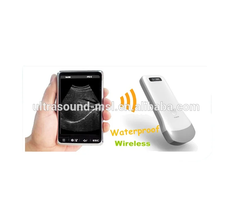 (MSLPU31F) New design medical device wireless USG ultrasound probe ...