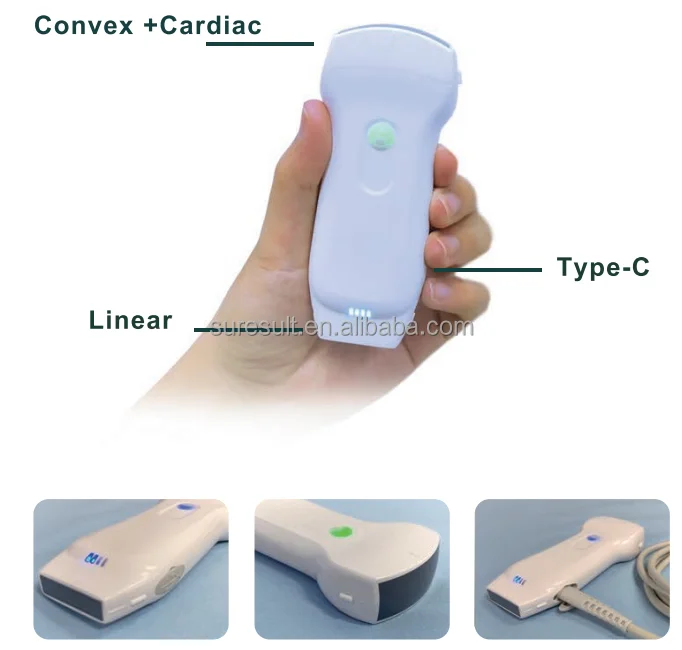 Suresult Handheld Dual Ultrasound - Portable and Versatile