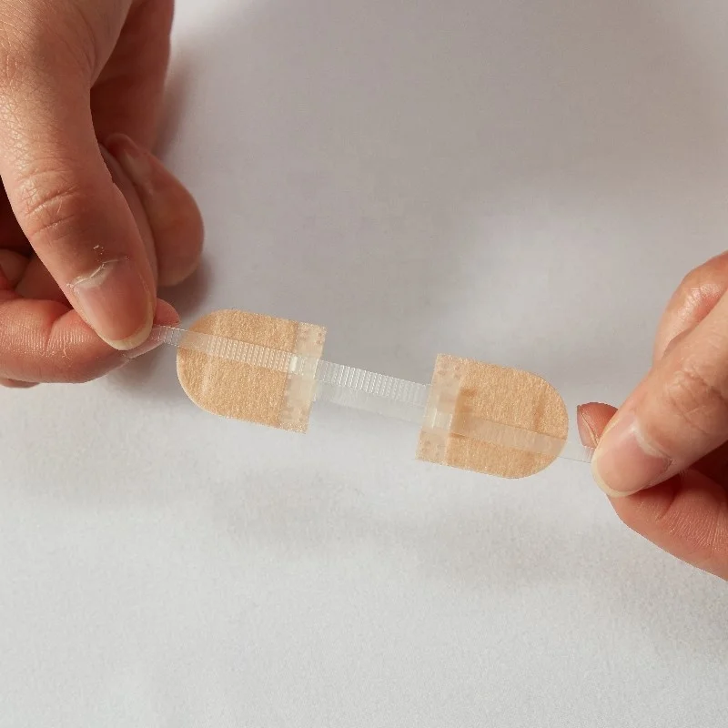 Hemostatic Adhesive Zip Tie Wound Closure Zip Stitches Medical Bandage ...