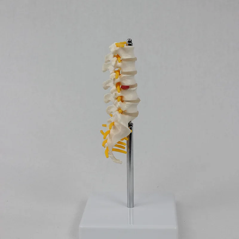 Medical Teaching Lumbar Vertebrae with Sacrum & Coccyx and Herniated ...