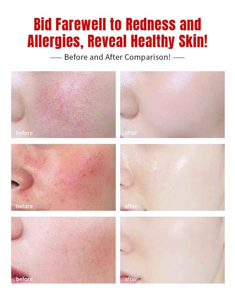 Oem Odm Skin Calming Face Cream Soothing Sensitive Skin Redness Relief ...