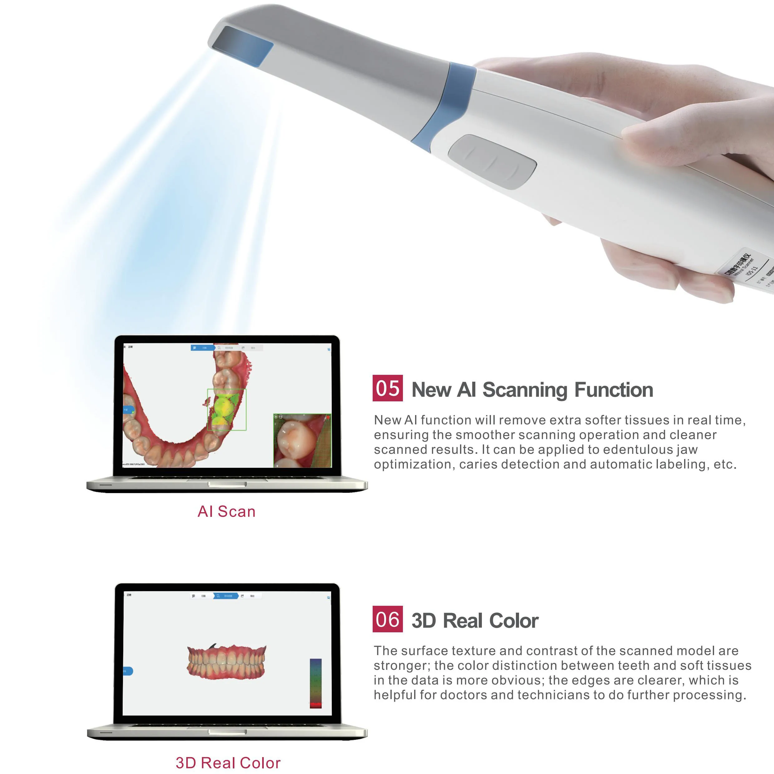 Runyes Factory Price Mini Oral Scanner 3d Dental Oral Scanner Dental ...