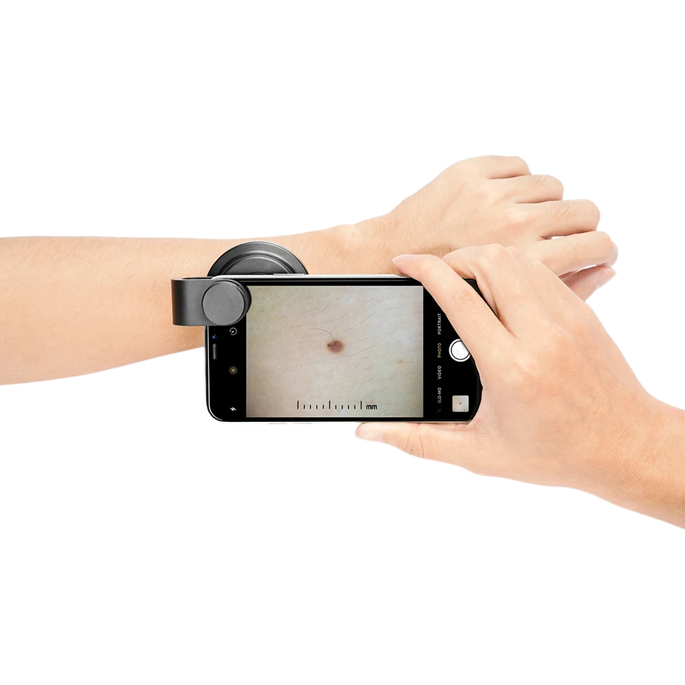Iboolo De-400 Visual Aid Device Smartphone Polarized Dermatoscope ...