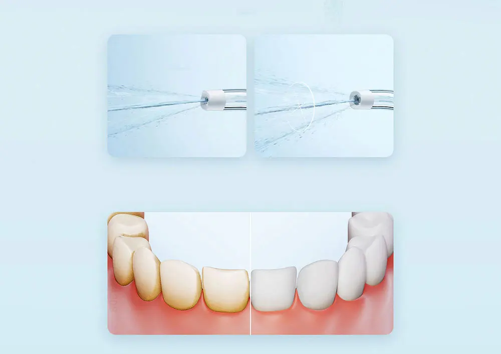 XIAOMI MIJIA MEO703 Portable Water Flosser - Efficient Tooth Cleaning
