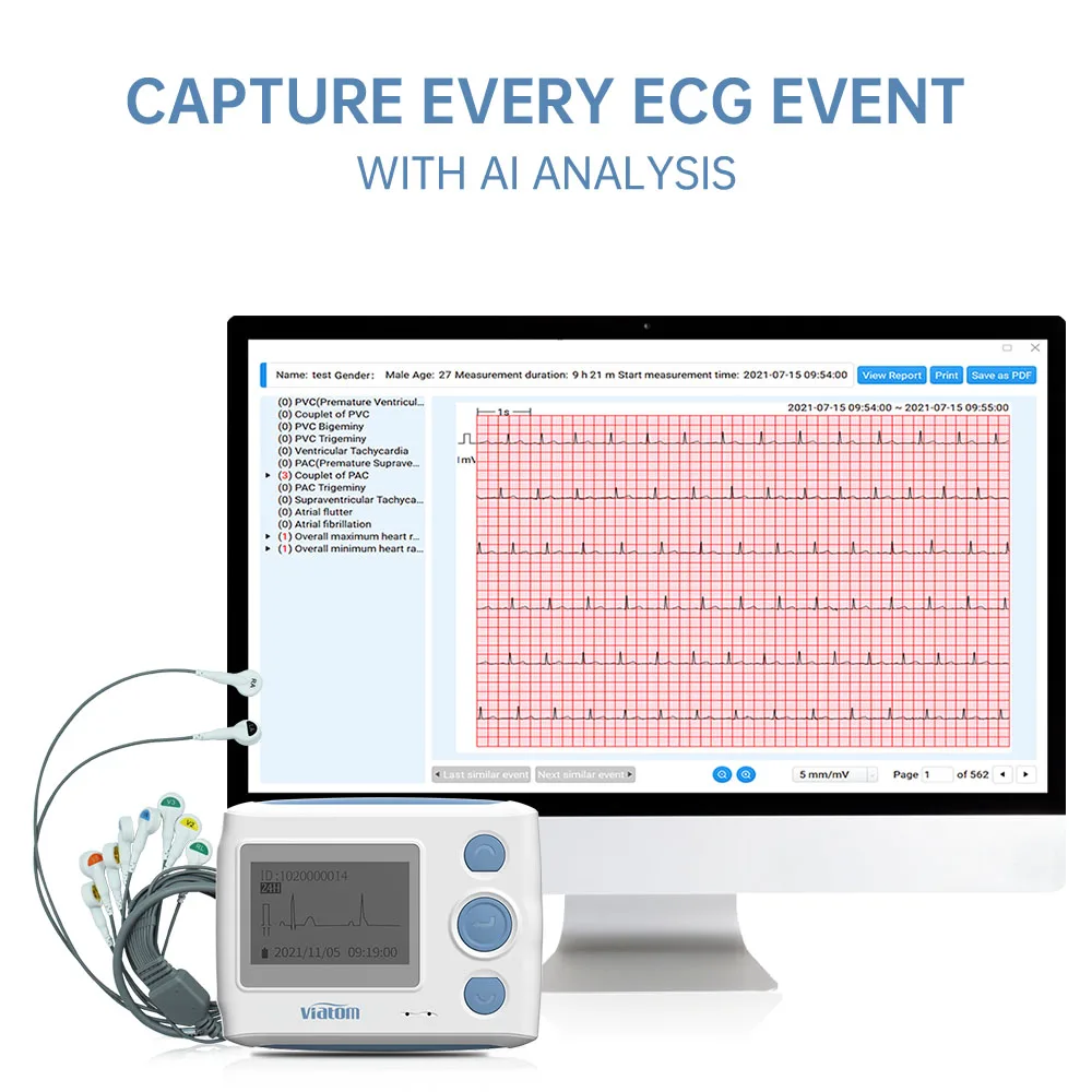 Viatom Th12 12-Channel Holter ECG Monitor - Portable ECG Device with AI ...
