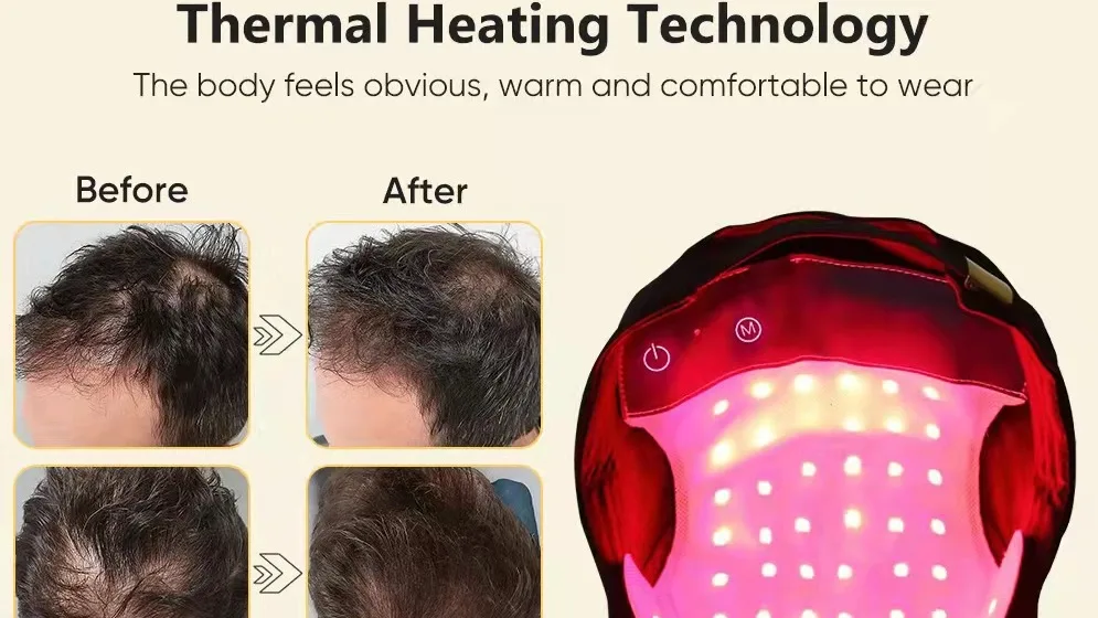 Sungrow 650nm Home Use Helmet Red Blue Hat Full Scalp Led Treatment ...