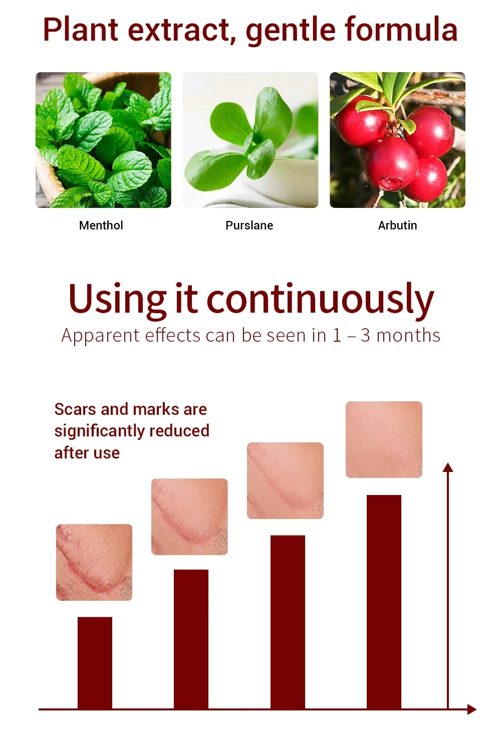 Deep Stretch Mark Acne Pockmark Repair Scar Repair Cream Acne Scar ...