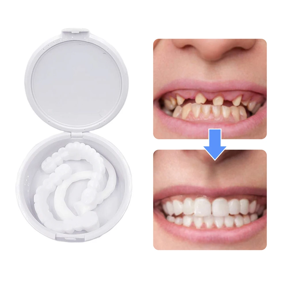 Comfortable Fit Temporary False Teeth Repair Kit - OEM Available
