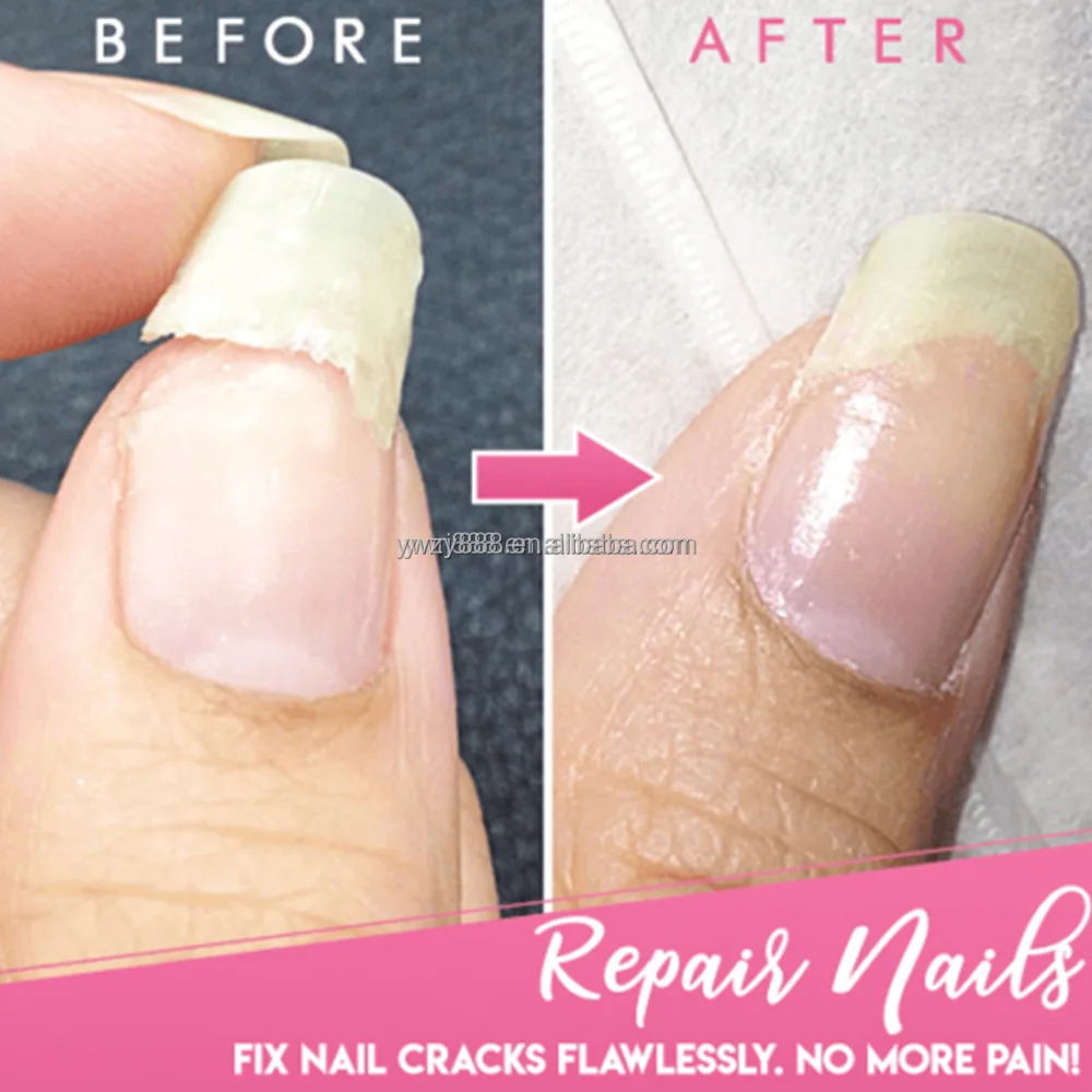 Alibaba.com: 5ml Fiber Extension Repair Gel Clear Poly Builder for nail ...