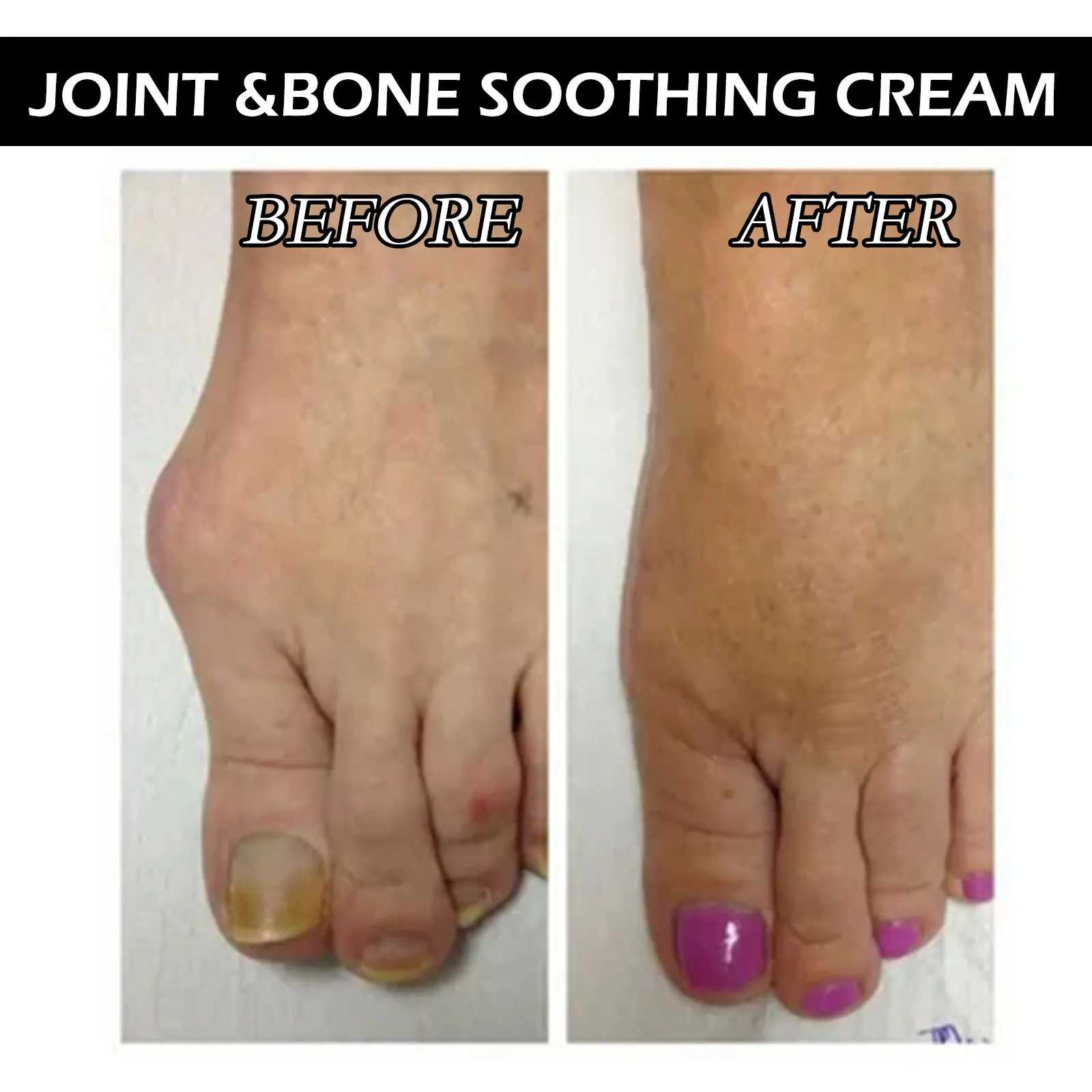 Popular Collagen Vitamin K2 & MSM Joint Pain Massage Cream