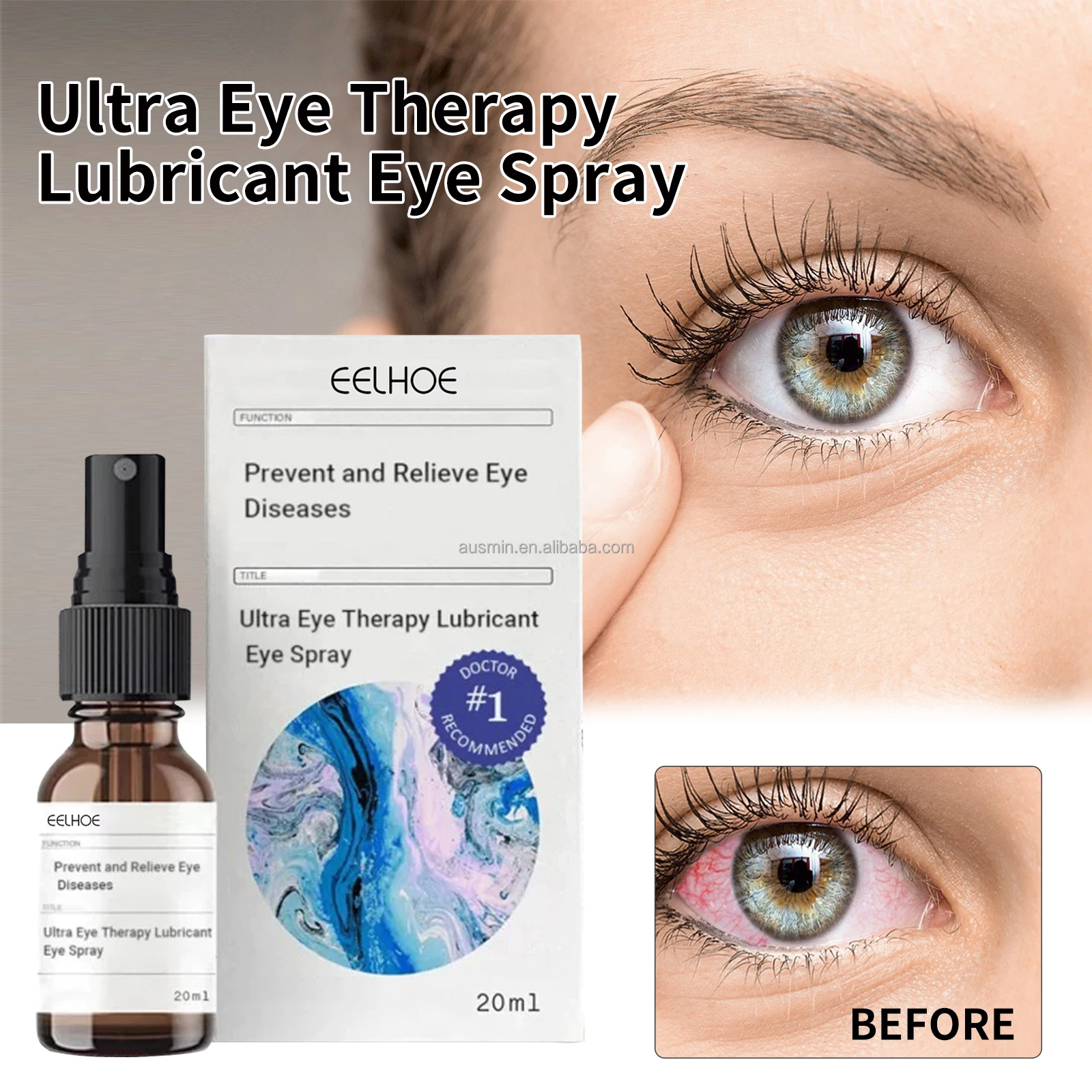 New Arrivals Ultra Eye Lubricant Spray Soothe Eyes Diseases Remove Red ...