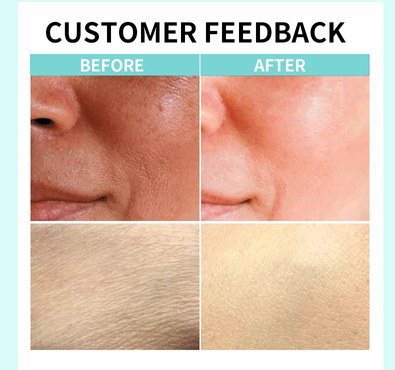 Glutathione Skin Lightening Cream - Nourishing & Rejuvenating
