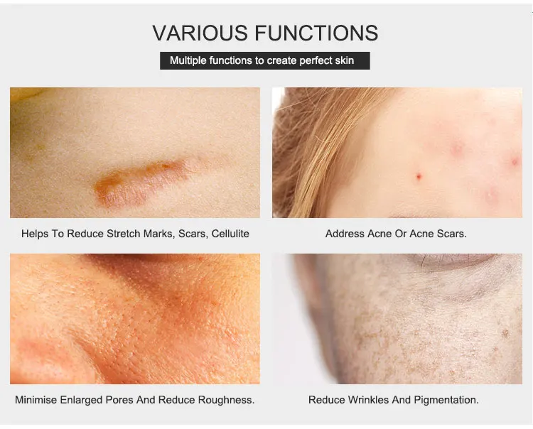 Adjustable 140 Needles Derma Stamp/derma Stamp Microneeding/stainless ...