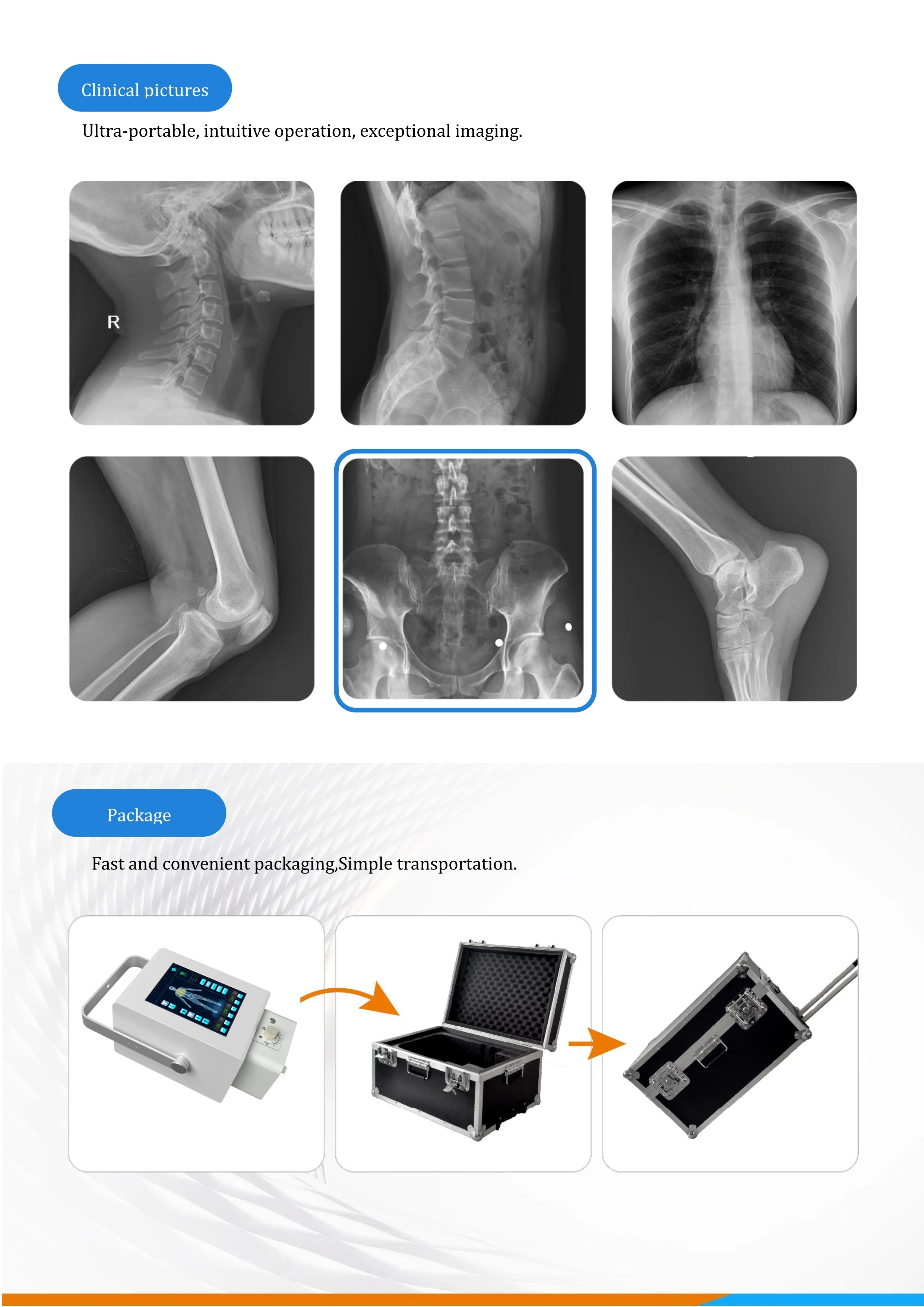 Portable X Ray Machine 10.4' 8KW/160mA Chest X-Ray Machine for Hospital ...