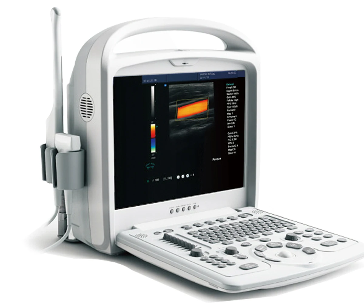 Medical Equipment Kr-c60 Portable Ultrasound Machine Color Doppler ...