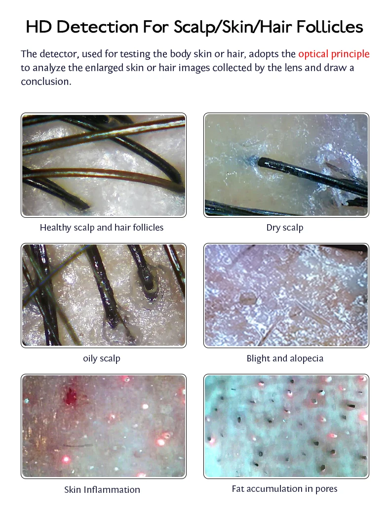 Scanner To See Hair Follicle Hair Follicle Scalp Scanner Hair Analysis ...