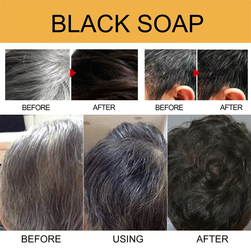 Jaysuing Black Soap - Natural Shampoo for Grey Coverage